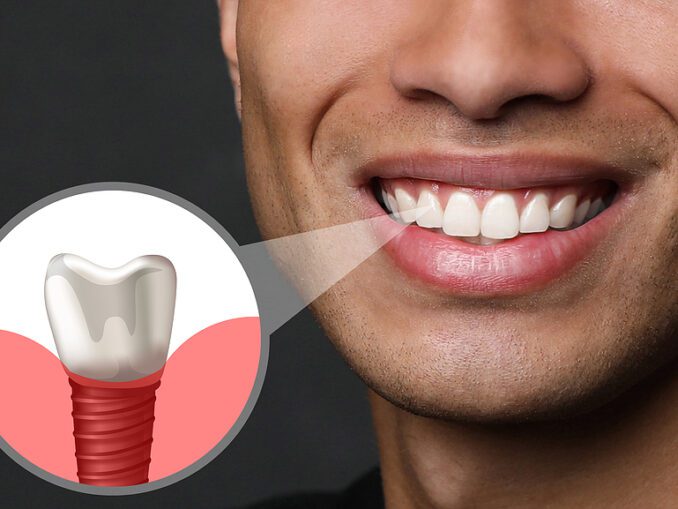 Pflasterallergie im Griff: Ursachen, Pflege und Vorbeugung - Senioren ...